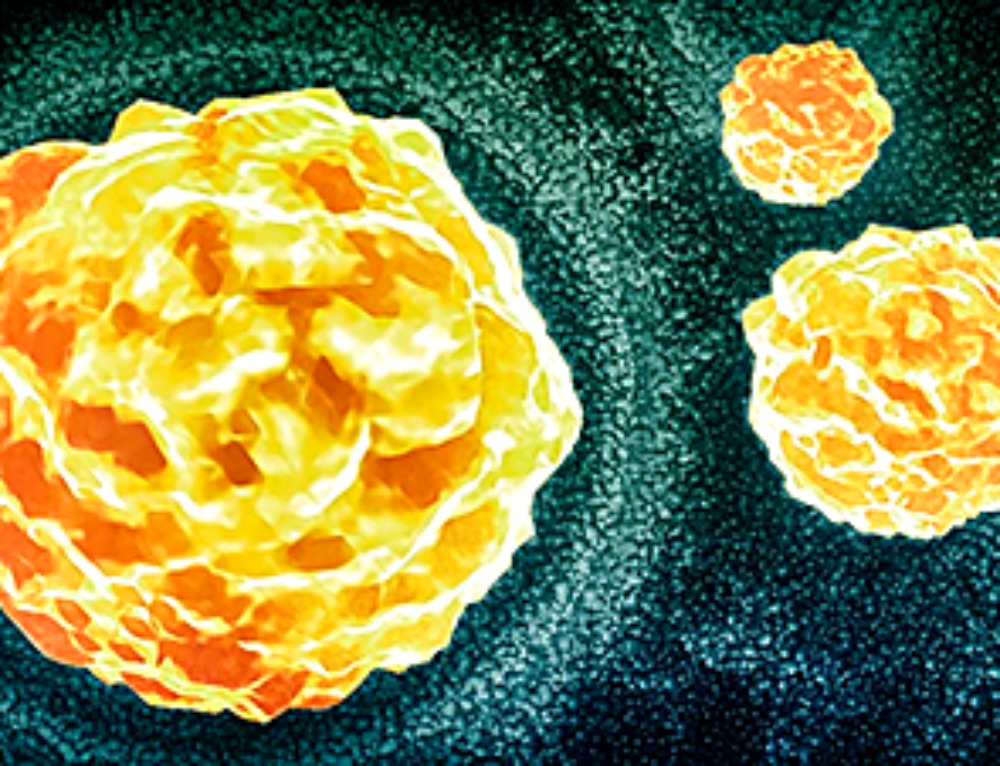 Updated – Worldwide Press for “Human Brain/Cloud Interface” – NanoApps ...