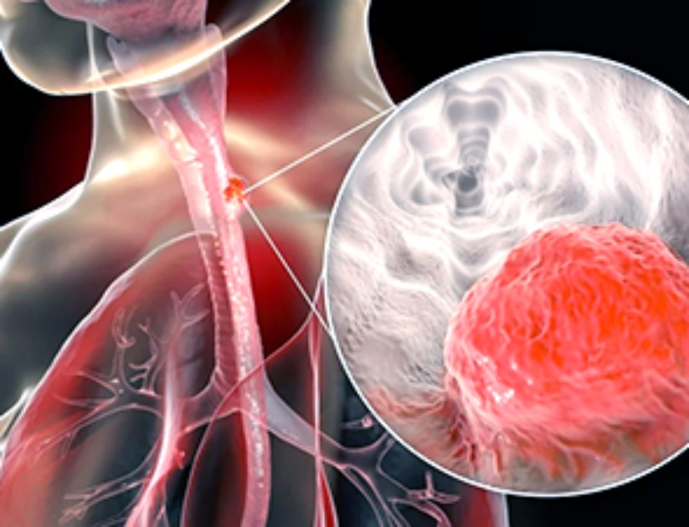 Updated – Worldwide Press for “Human Brain/Cloud Interface” – NanoApps ...