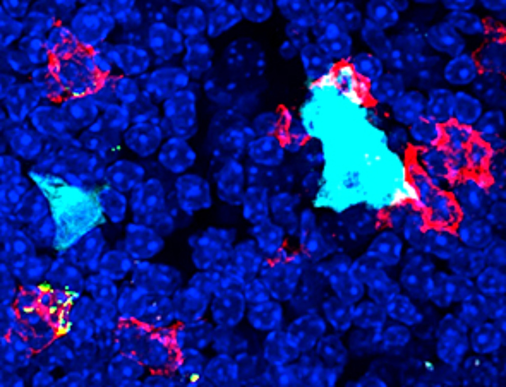Phosphorene Nanoribbons – new wonder material could revolutionise ...